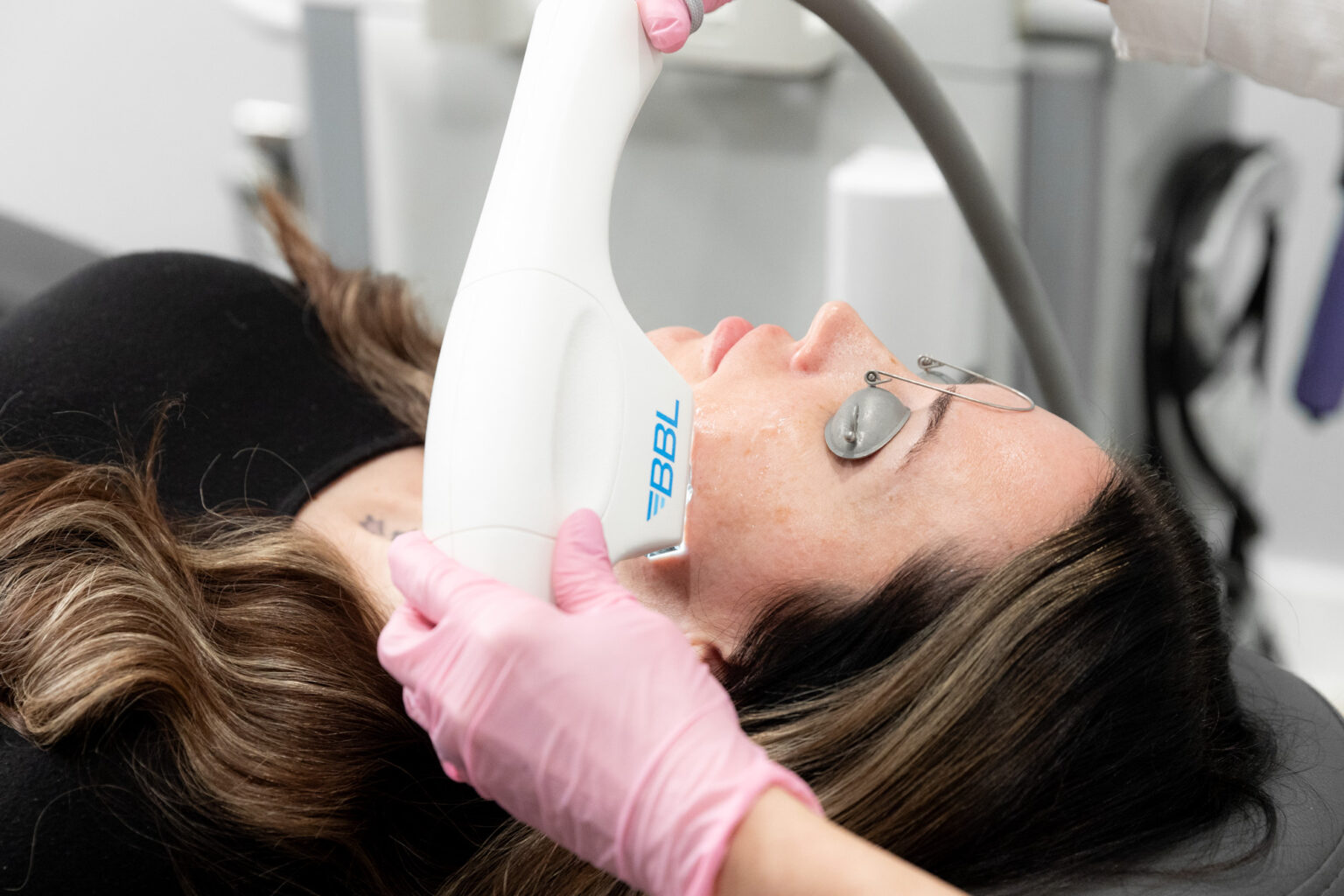 BBL Photofacial in Columbus - Blush Aesthetics
